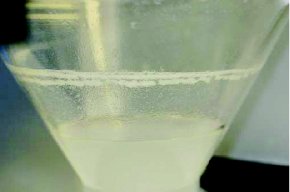 Generic Automated Sample Preparation Including Online HPLC Analysis for ...