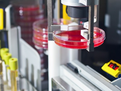 Optimizing and Future-Proofing Bacterial Endotoxin Testing with ...