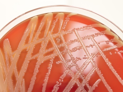 European Pharmacopoeia Approach to Testing for Pyrogenicity | American ...