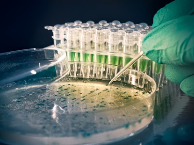 Validation Strategy for New Recombinant Factor C Users | American ...