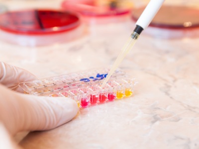 Mycoplasma Testing in an Ever-Changing World | American Pharmaceutical ...