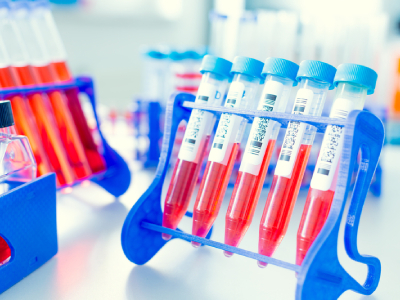 Donaldson Acquires Univercells Technologies, Broadens Life Sciences ...