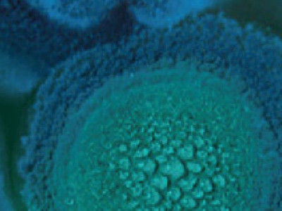 Instrumentation The Value and Benefits of Rapid Mold Detection in the ...