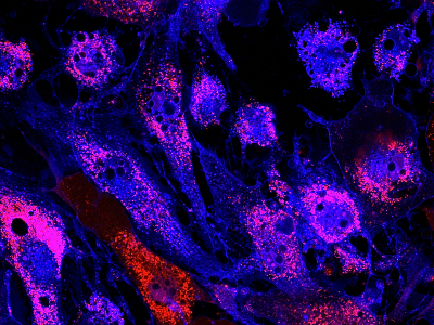 Kala Pharmaceuticals Announces Name Change to KALA BIO | American ...