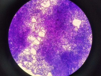 Sucralfate Oral Suspension Recalled Due to Microbial Contamination ...