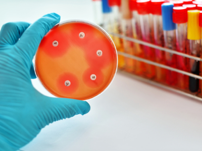 Microbial Testing for the Pharmaceutical Industry | American ...