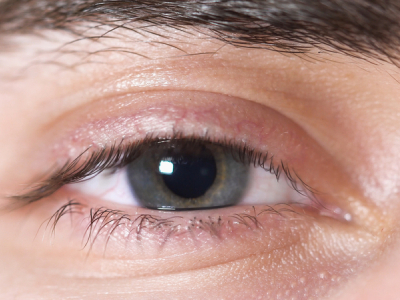 AstraZeneca’s Soliris Approved in China for the Treatment of ...