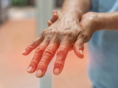 FDA Approves Takeda’s HYQVIA® as Maintenance Therapy in Adults with ...
