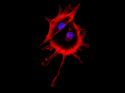 Roche Receives EC Approval of Tecentriq® SC with ENHANZE® Representing ...