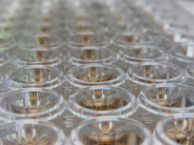 AstraZeneca Completes Gracell Acquisition | American Pharmaceutical ...