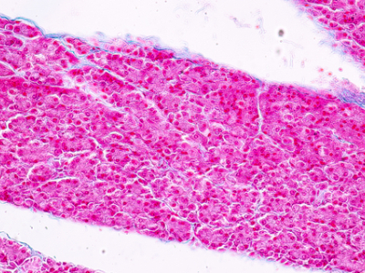 AstraZeneca to Acquire Amolyt Pharma for $1.05B | American ...