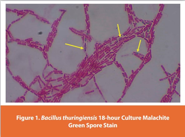 Spore Stain Bacillus Megaterium