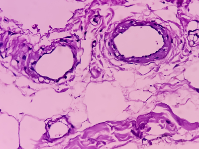 Ipsen and Sutro Biopharma Announce Global Licensing Agreement for an ...