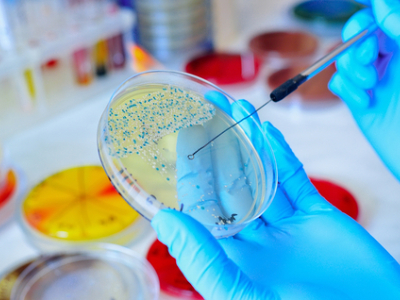 Using Rapid Microbiological Methods Flexibly to Ensure Safe Cell and ...