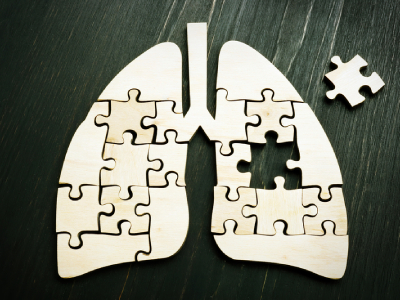 MannKind Receives FDA Fast Track Designation for Clofazimine Inhalation ...