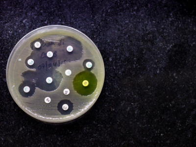 Evaluating Rapid Microbial Methods: A Comprehensive Approach to Testing ...