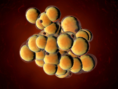 FDA Approves First Treatment for Rare Lipid Storage Disease | American ...