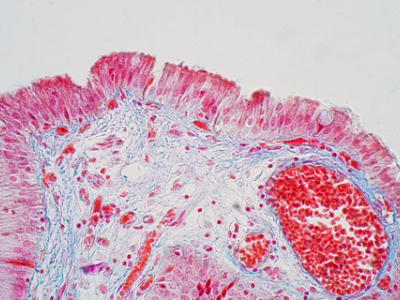 Kenox Pharmaceuticals to Collaborate with Lactiga to Advance Mucosal ...